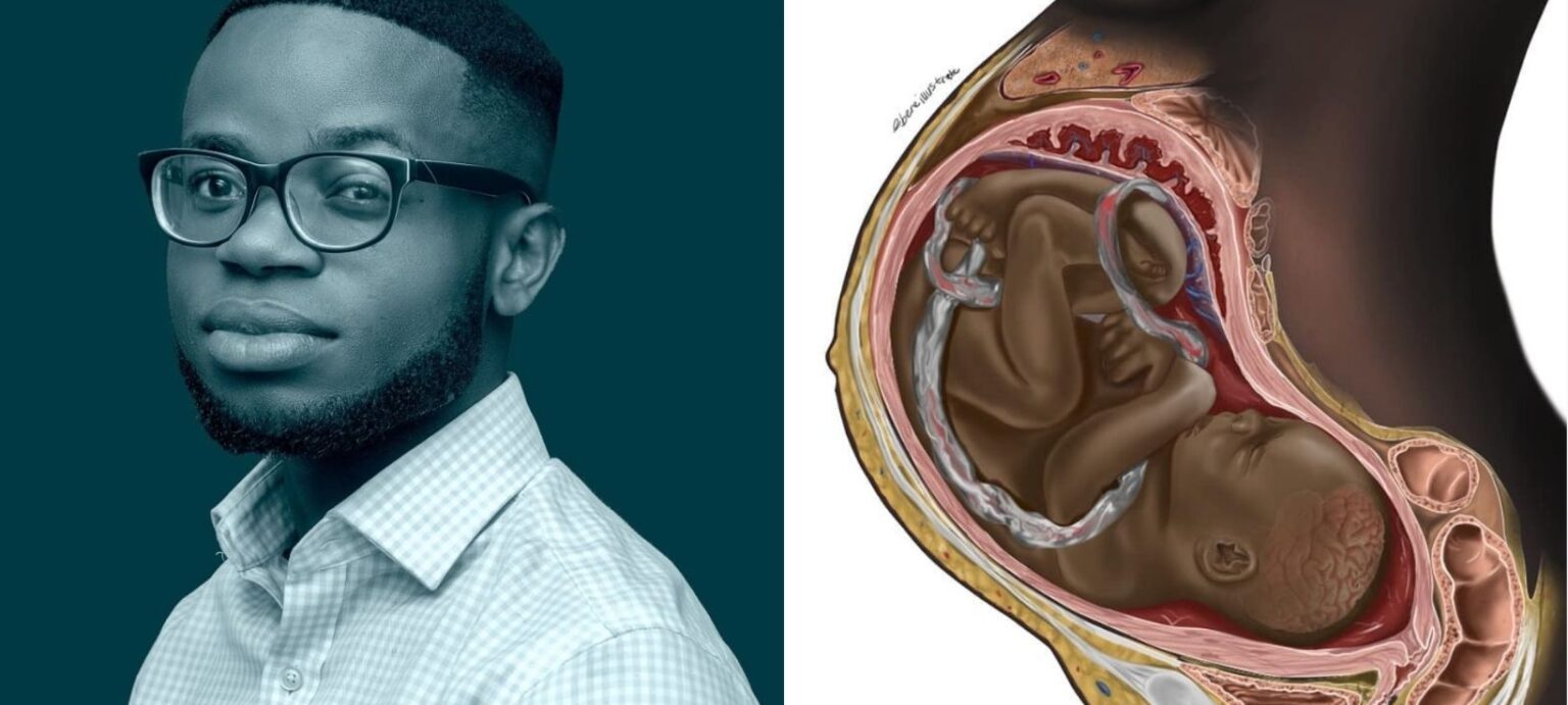 Rising Medical Student Illustrates Anatomy Images Featuring Black ...
